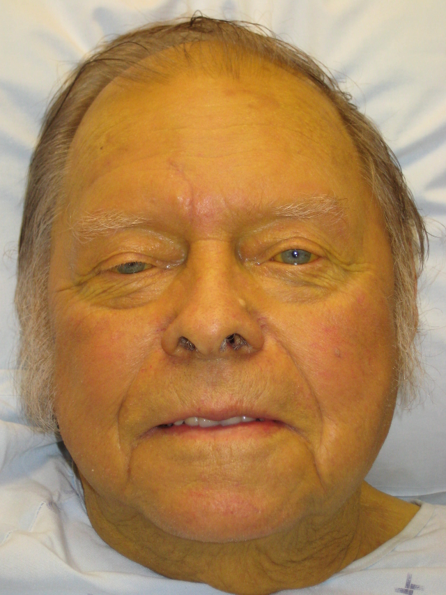 Icterícia – Hepcentro