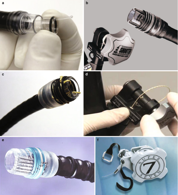 Ligadura Elástica de Varizes Esofágicas – Hepcentro