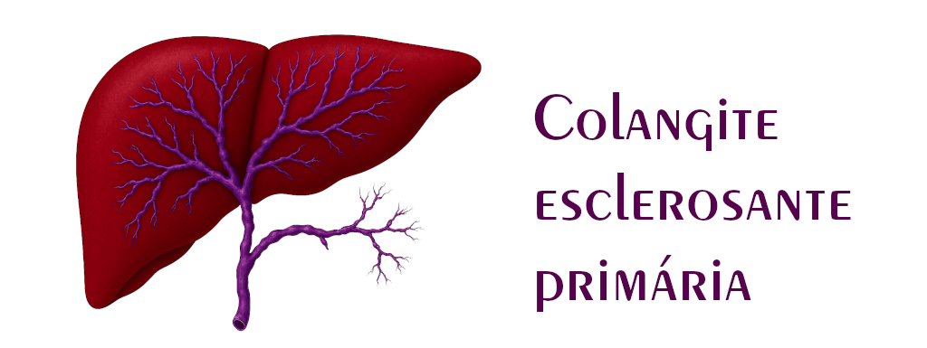 Artigo atualizado: Colangite Esclerosante Primária – Hepcentro